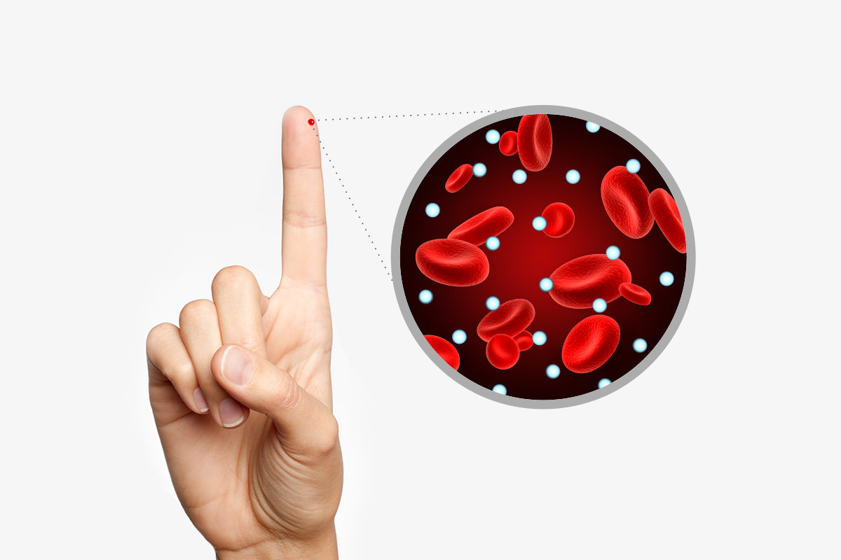 Inzulinska rezistencija - Labos laboratorij Sarajevo, Tešanjska 1 - M. Dvor