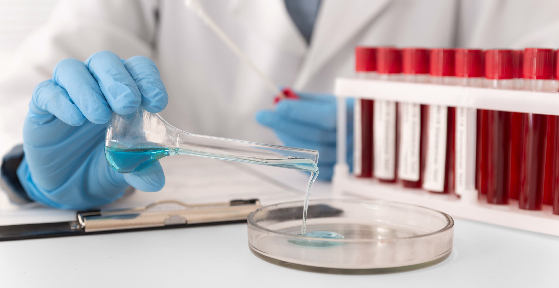 O nama - Labos medicinsko-biohemijska laboratorija Sarajevo, Tešanjska 1